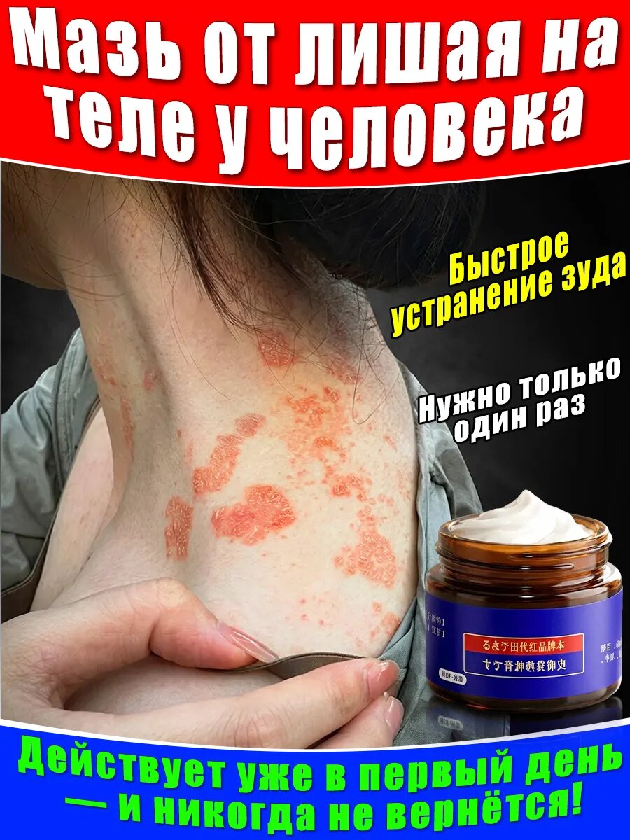 Мазь от лишая человеку на теле