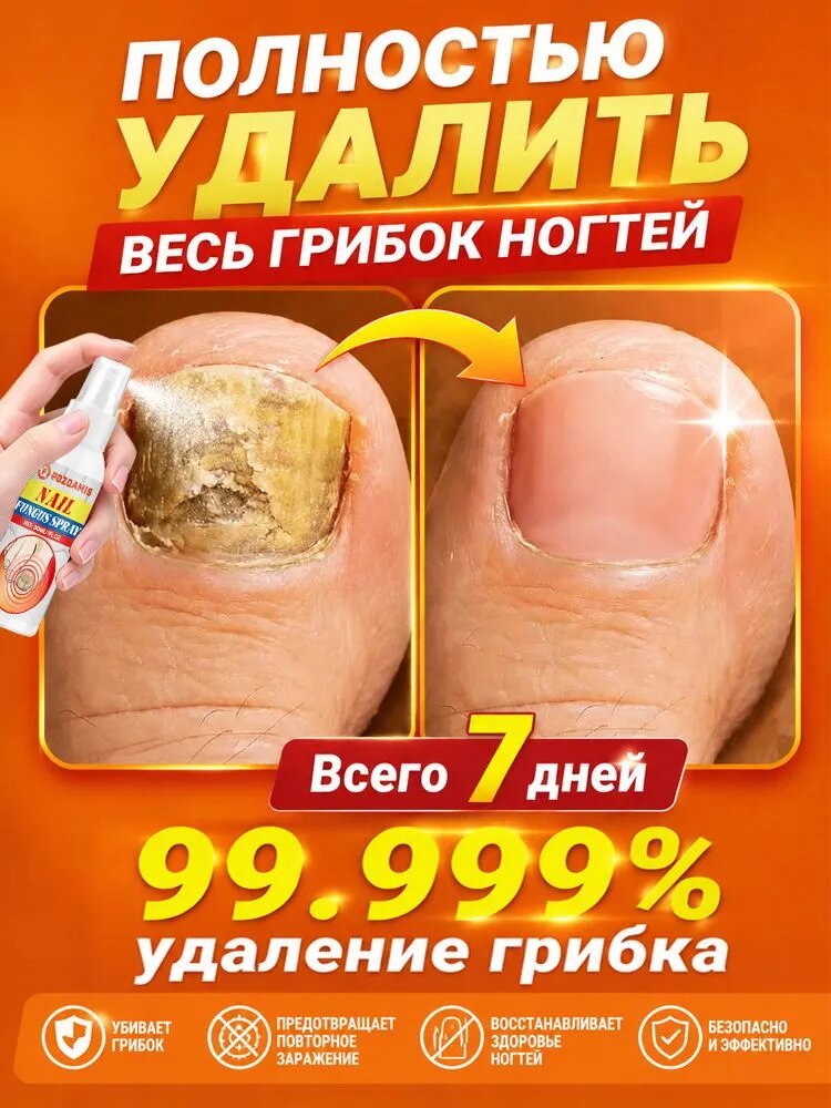 Спрей для лечения грибка ногтей, 30 мл, способствует росту и укреплению ногтей и используется для ухода за ногтями и кожей.