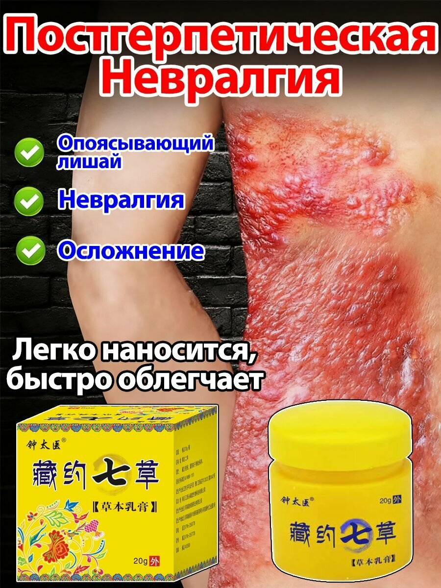 Мазь от опоясывающего лишая