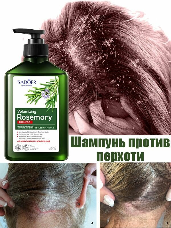 Мощный шампунь против перхоти с розмарином для бережного лечения себорейного дерматита, подходит для сухих волос,500мл