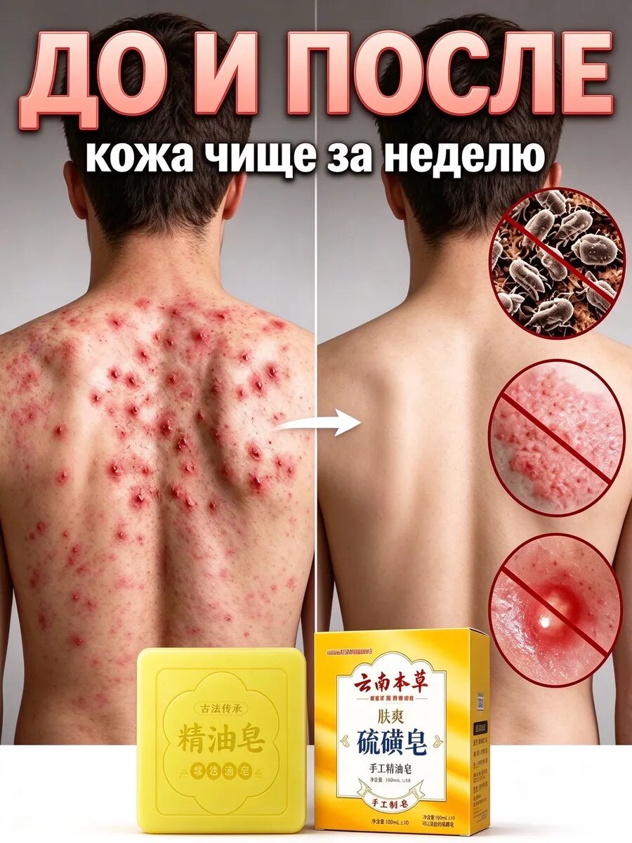 Мыло серное от блох 100г
