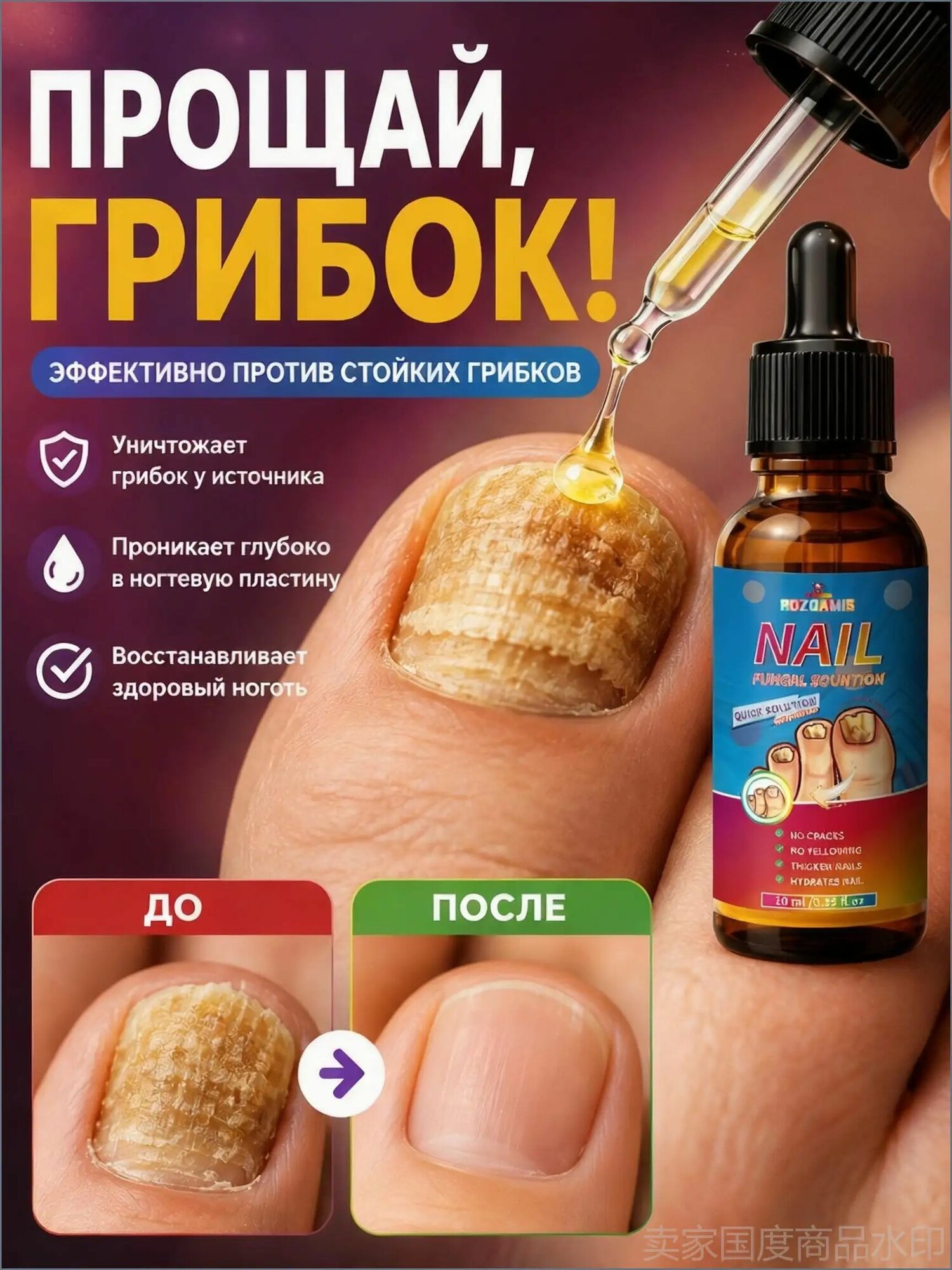 Высокоэффективное противогрибковое эфирное масло, подходящее для лечения грибковых инфекций ногтей и трещин на ногтях, укрепления и восстановления ногтей и кутикулы. 10 мл