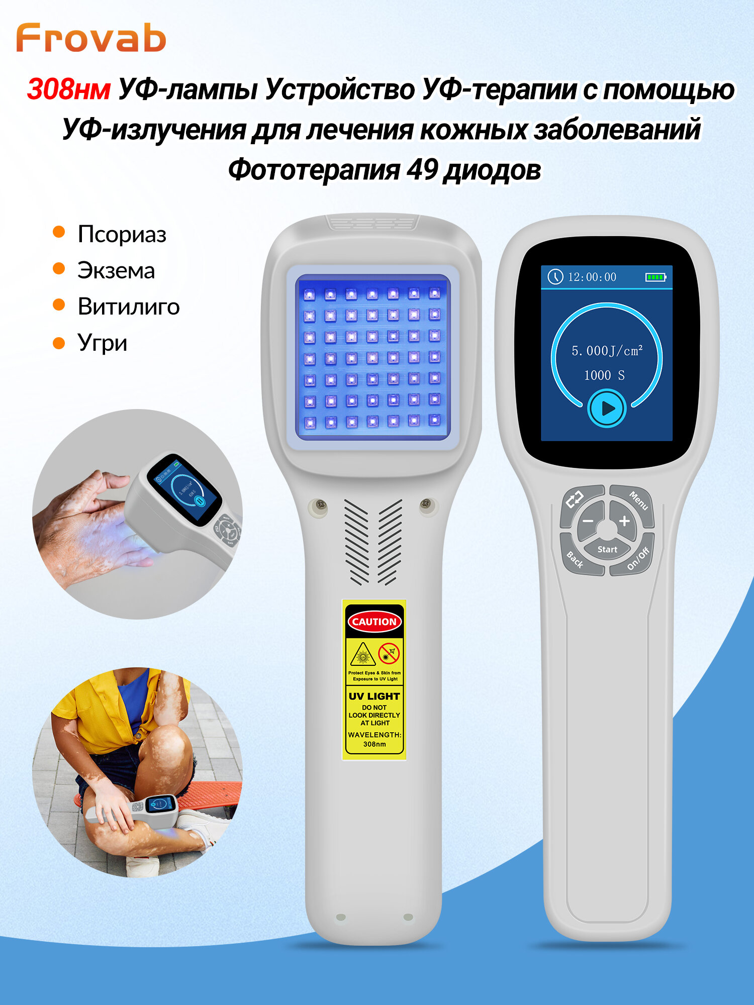 Домашний прибор Frovab 308нм 49 диода, доза 0-5 Дж/см², избавление от дерматита, акне и кожных дефектов