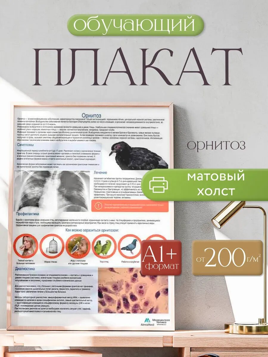 Орнитоз медицинский плакат матовый холст от 200 г/кв. м, размер A1+