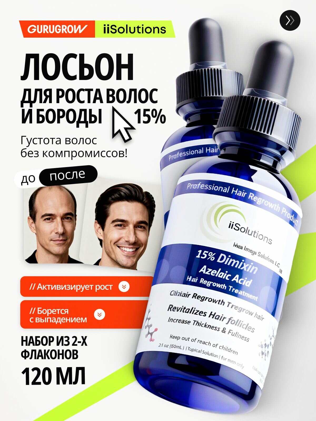 IiSolutions 15% лосьон для роста волос и бороды, 60 мл, 2 флакона