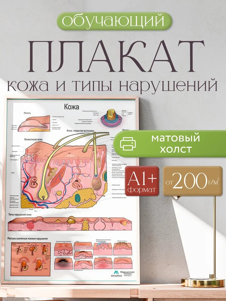 Кожа и типы нарушений, плакат матовый холст от 200 г/кв. м, размер A1+