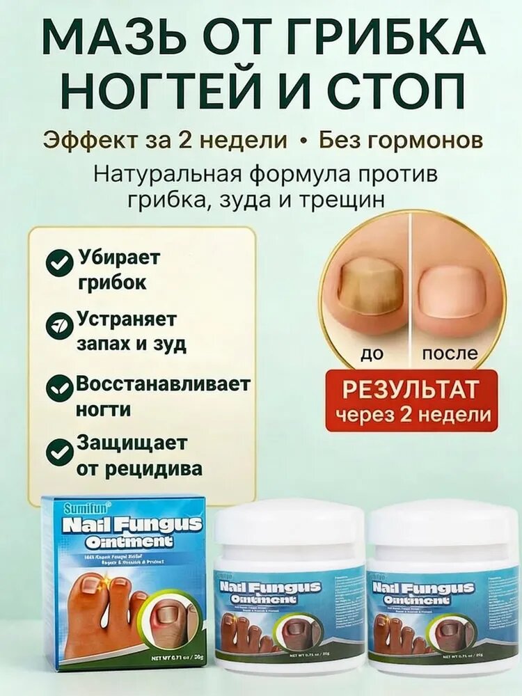 Мазь от грибка ногтей / Крем для эффективной борьбы с несовершенствами / Чудо средство для ухода за ногами против онихолизиса