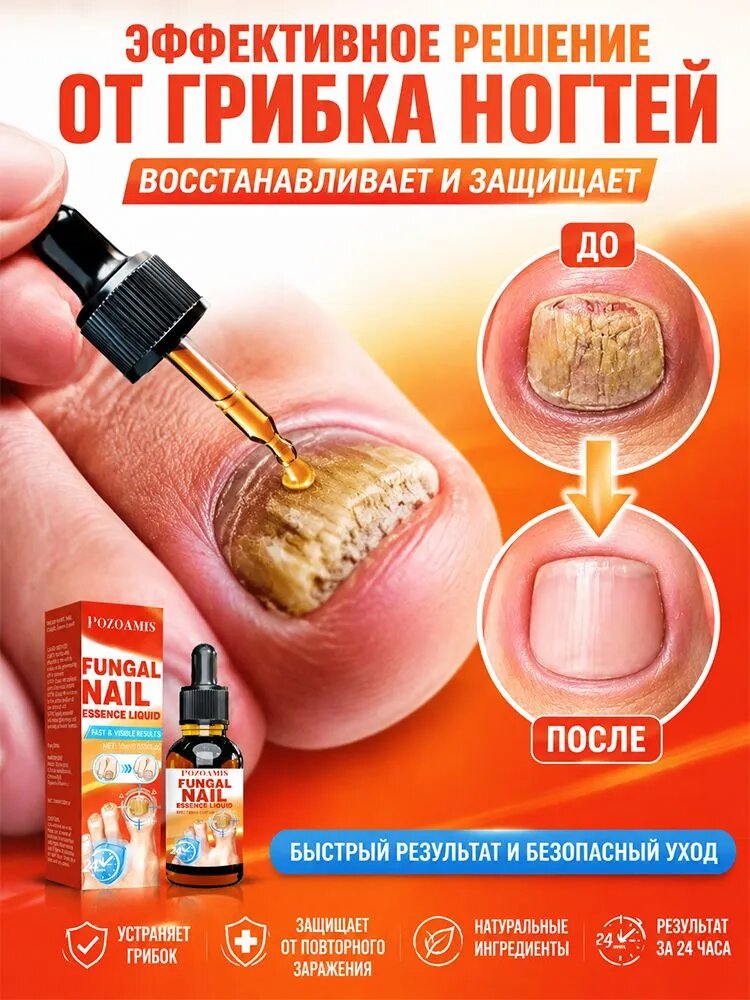 Эфирные масла, которые могут эффективно лечить грибковые инфекции ногтей, способствовать заживлению ногтей и лечить онихомикоз.