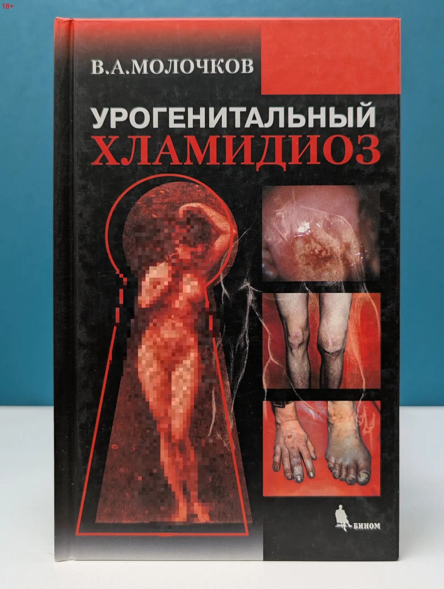 Урогенитальный хламидиоз Молочков Владимир Алексеевич 2006