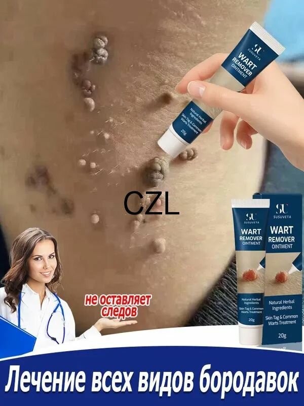 Средство от папиллом и бородавок Эффективное удаление папиллом на шее и теле, средство от бородавок и папиллом