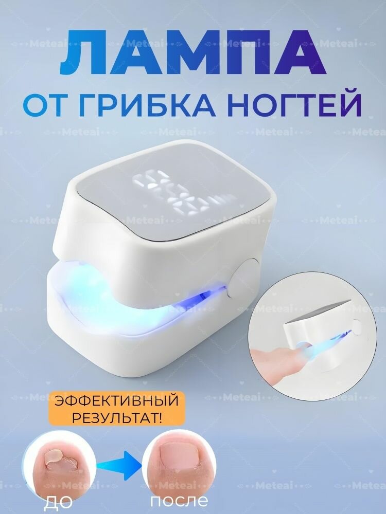 Лампой для лечения грибка и онихолизиса