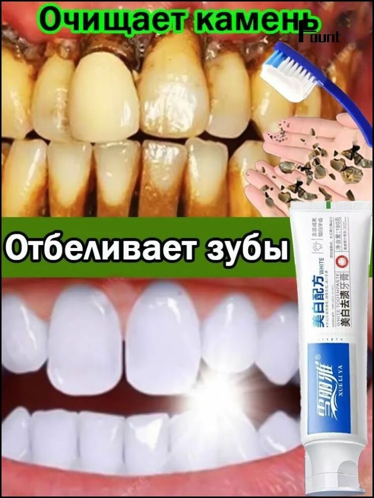 Эксклюзивный гель для безупречного отбеливания эмали, устранения налета и заботы о деснах