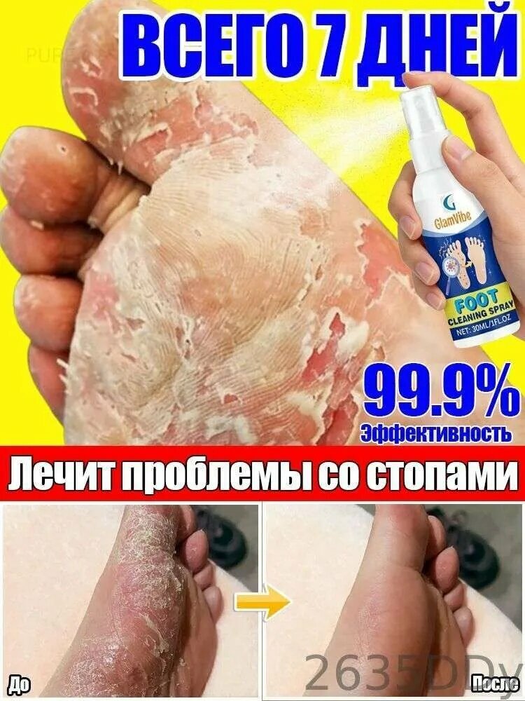 Cпрей для ног от запаха и пота, противогрибковое средство для ног и обуви устраняет зуд, запах и пот, шелушение, обладает антибактериальным действием,30мл