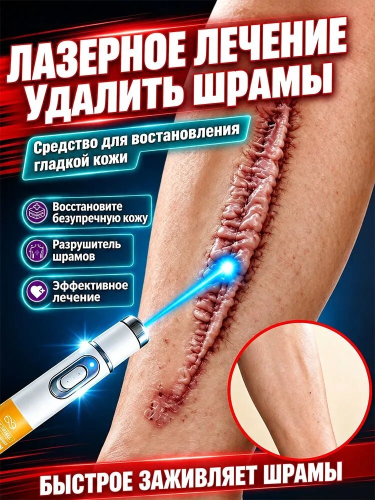 Лазерный аппарат от шрамов, рубцов, растяжек и следов ожогов, восстановление кожи, предотвращает рубцевание, от жировых отложений, 1 упаковки
