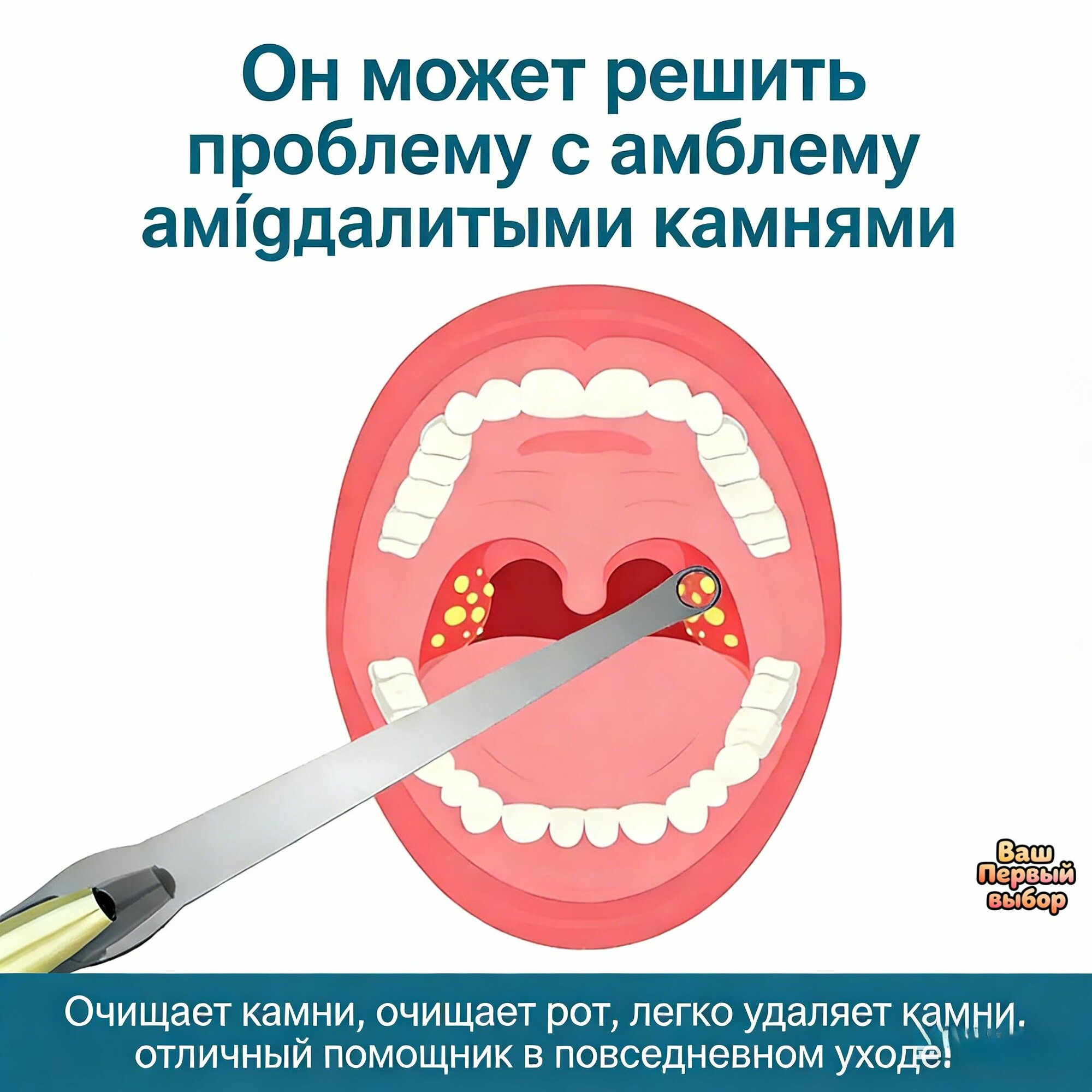 Инструмент для удаления камней с миндалин