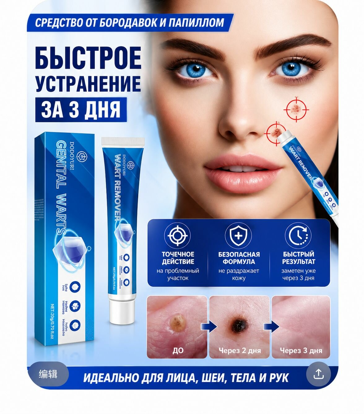 От бородавок 7 дня удаление папиллом, родинок и подошвенных бородавок. Безболезненно, без остатка, без побочных эффектов безопасное и эффективное восстановление кожи.