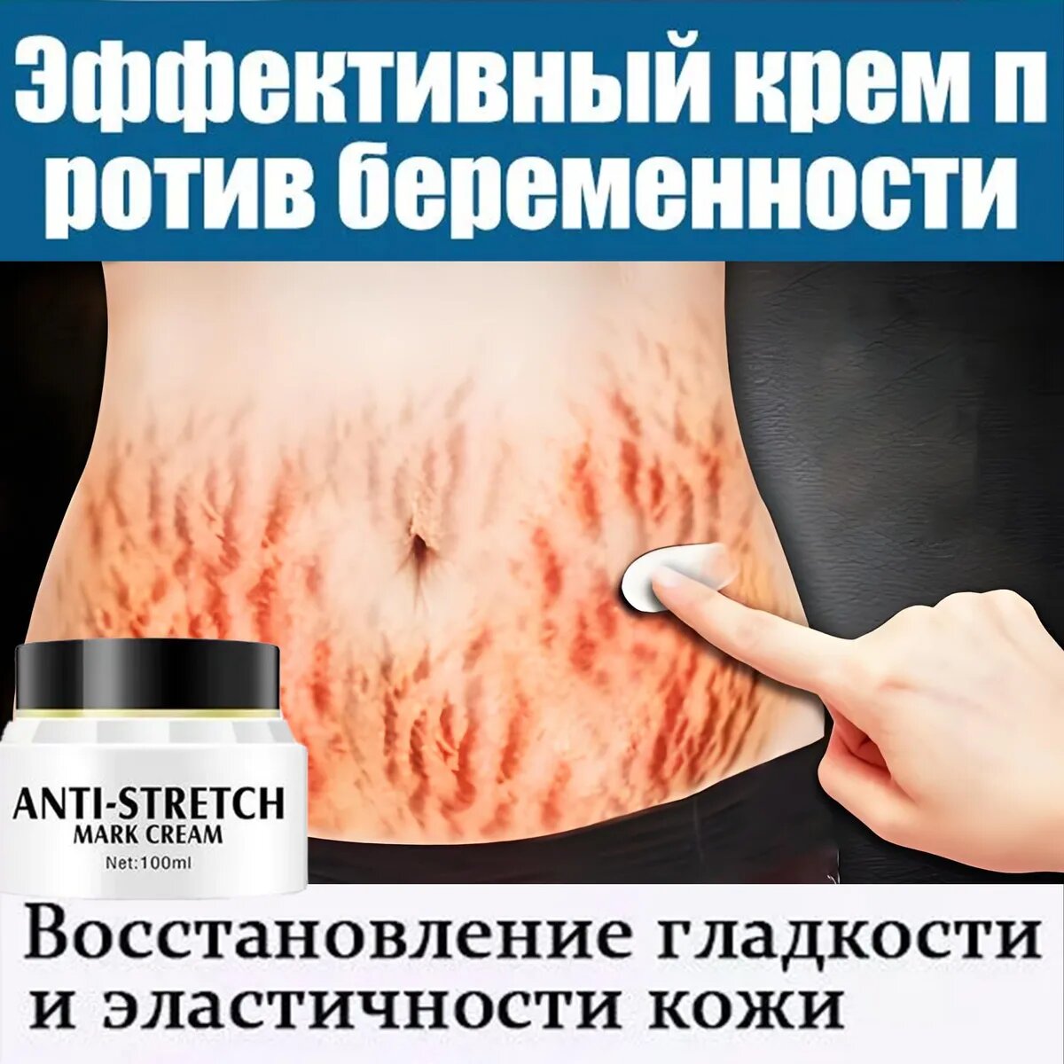 Средство от растяжек против растяжек растяжки