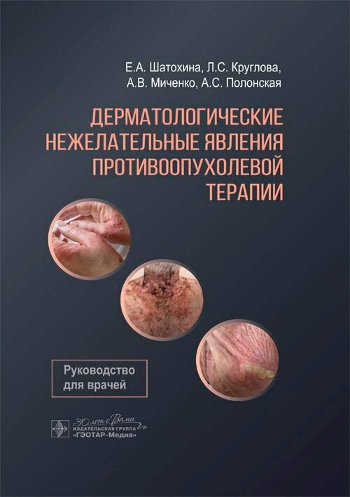 Дерматологические нежелательные явления противоопухолевой терапии : руководство для врачей / Е. А. Шатохина, 2025 464 c.