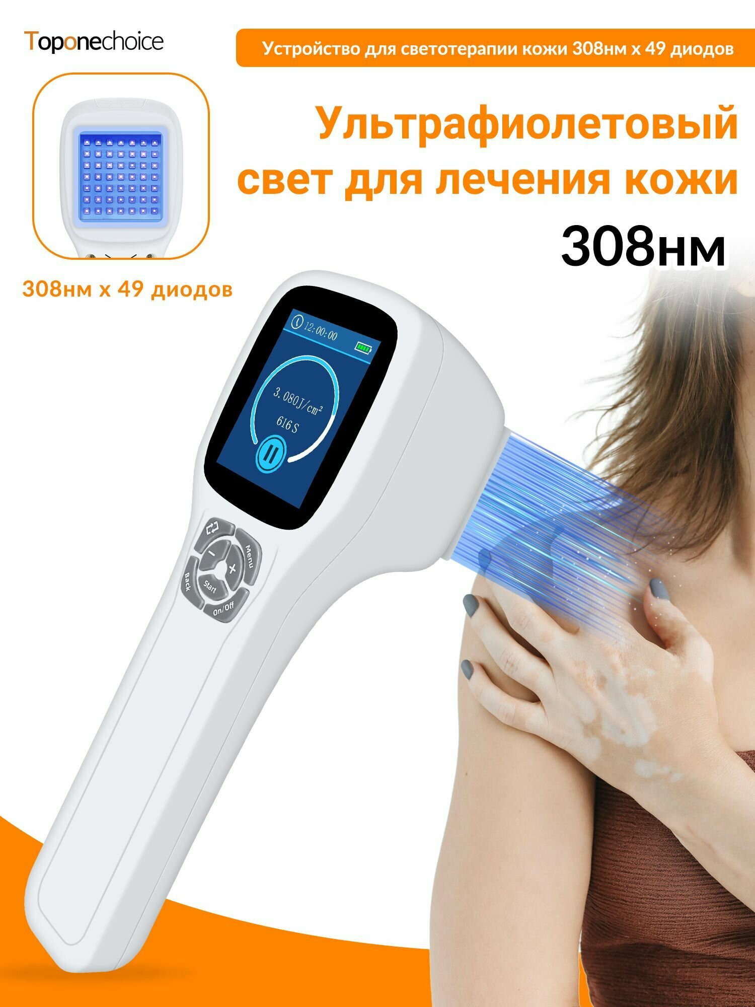 Toponechoice Ультрафиолетовый прибор 308 нм, бережный уход и поддержка здоровья кожи
