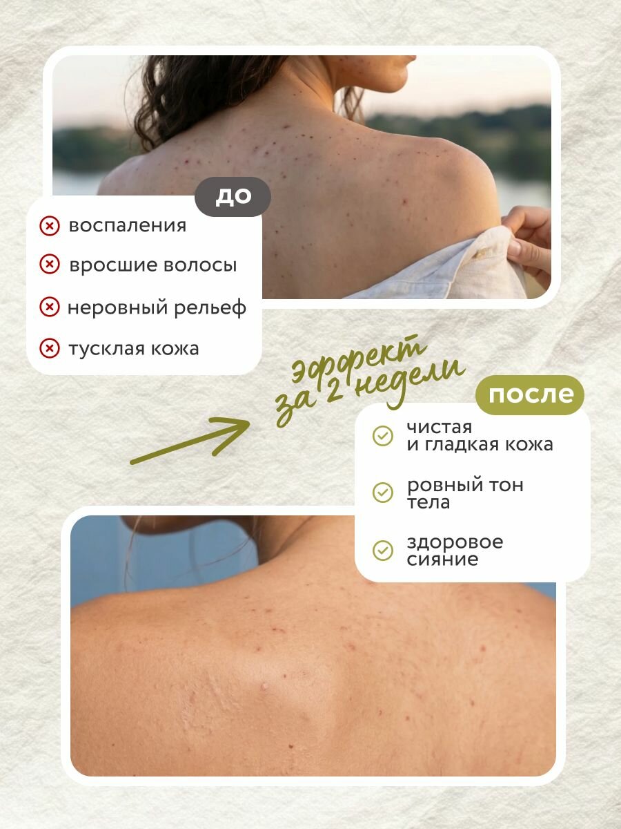 Laboratorium Гель для душа очищающий с AHA кислотами против прыщей — фото 1
