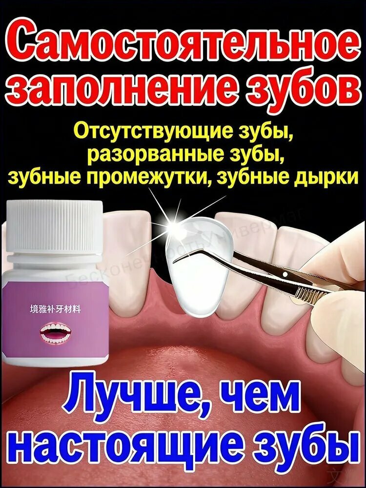 Эксклюзивный набор для реставрации, включающий стоматологическую смолу и клей для заполнения промежутков между зубами