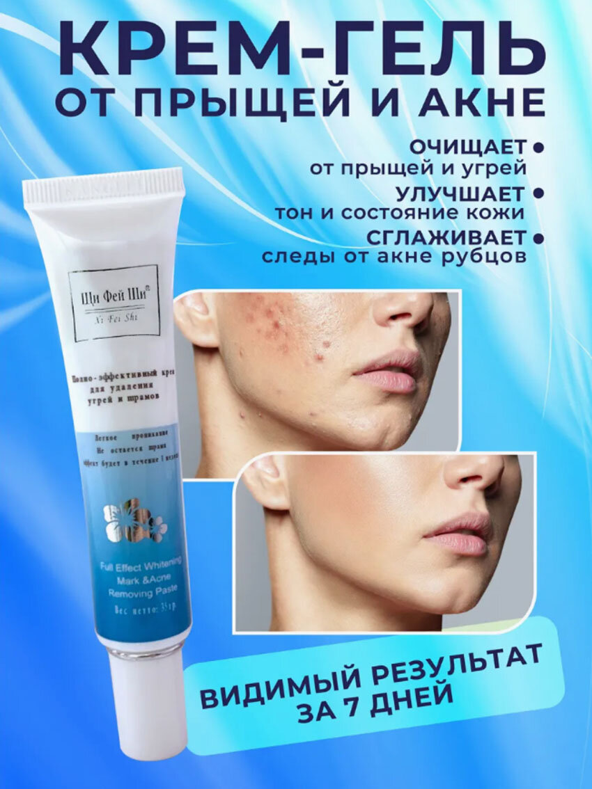 Гель от угрей и шрамов Щи Фей Ши