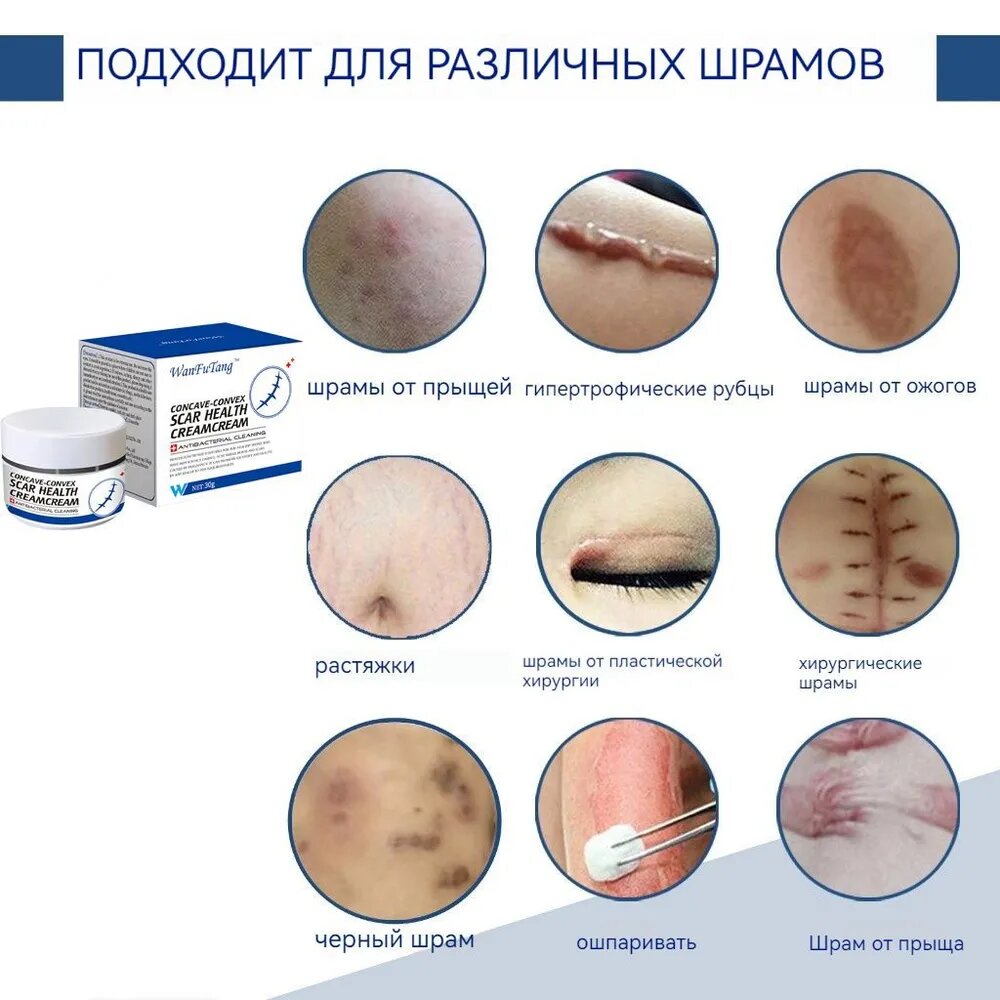 Крем для ухода за кожей SCAR HEALTH CREAMCREAM от шрамов и рубцов 100% эффективно — фото 1