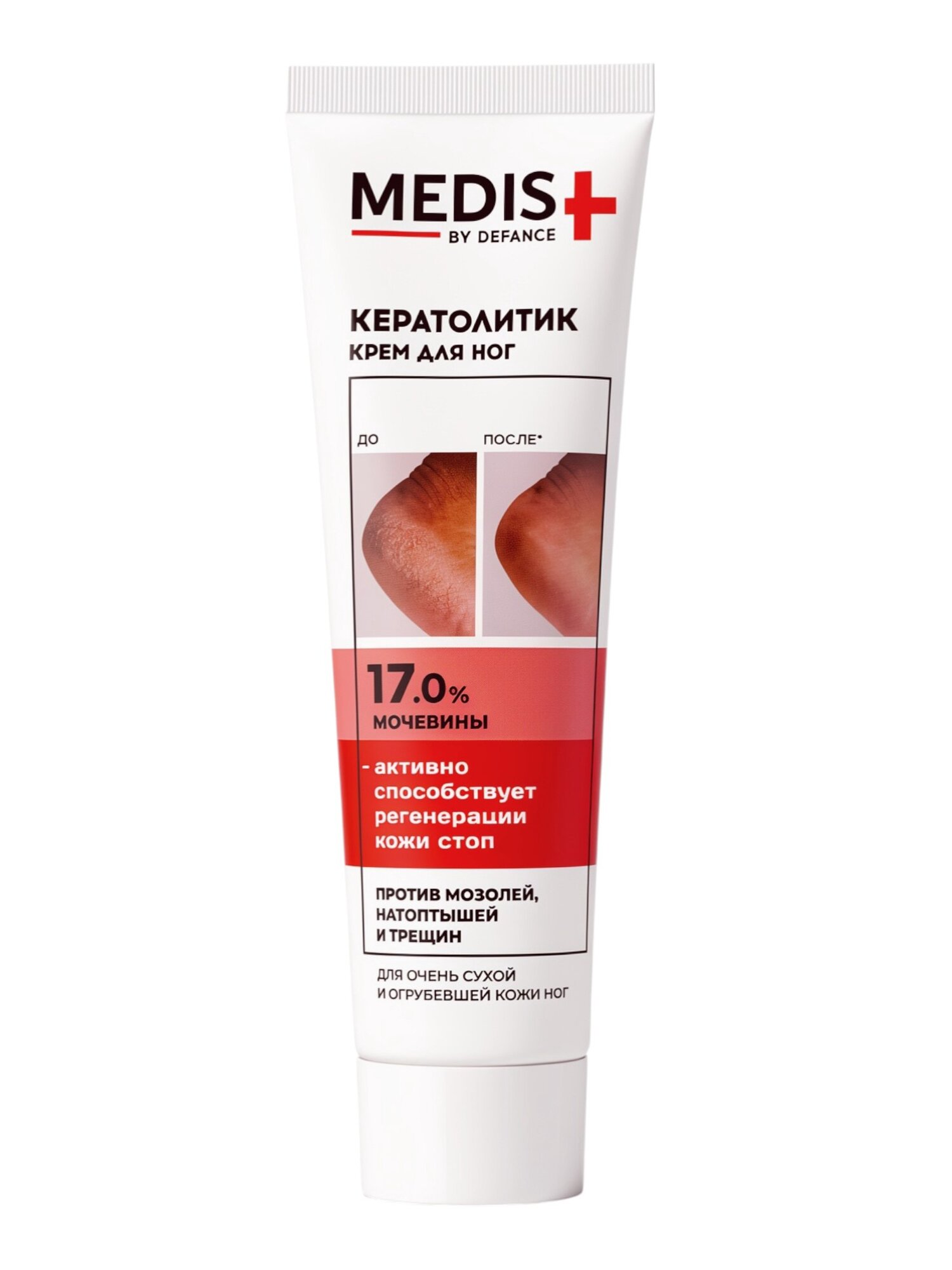 Крем кератолитик для ног DEFANCE MEDIS, против трещин, натоптышей и ороговевшей кожи, 100 мл