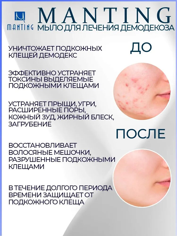 Твердое мыло — фото 1