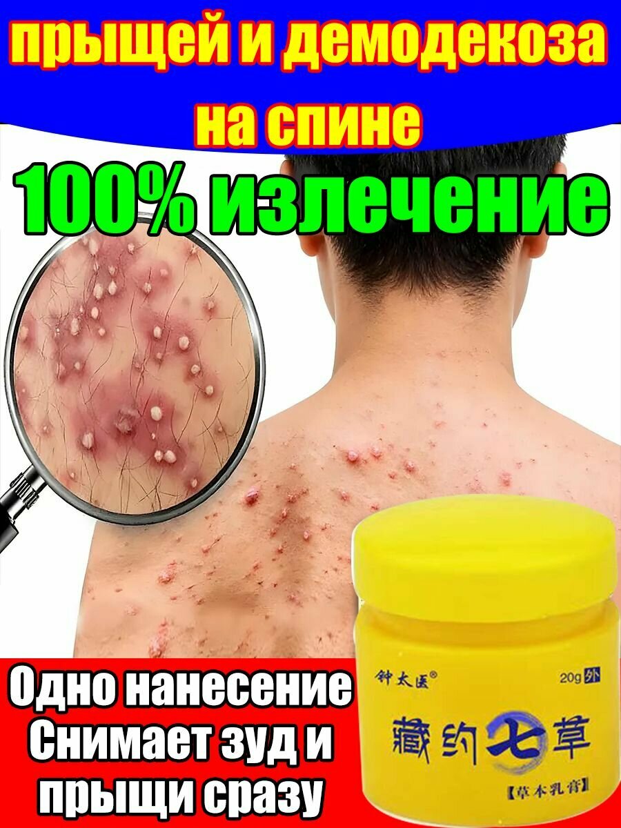 Мазь от чесотки и демодекоза для людей