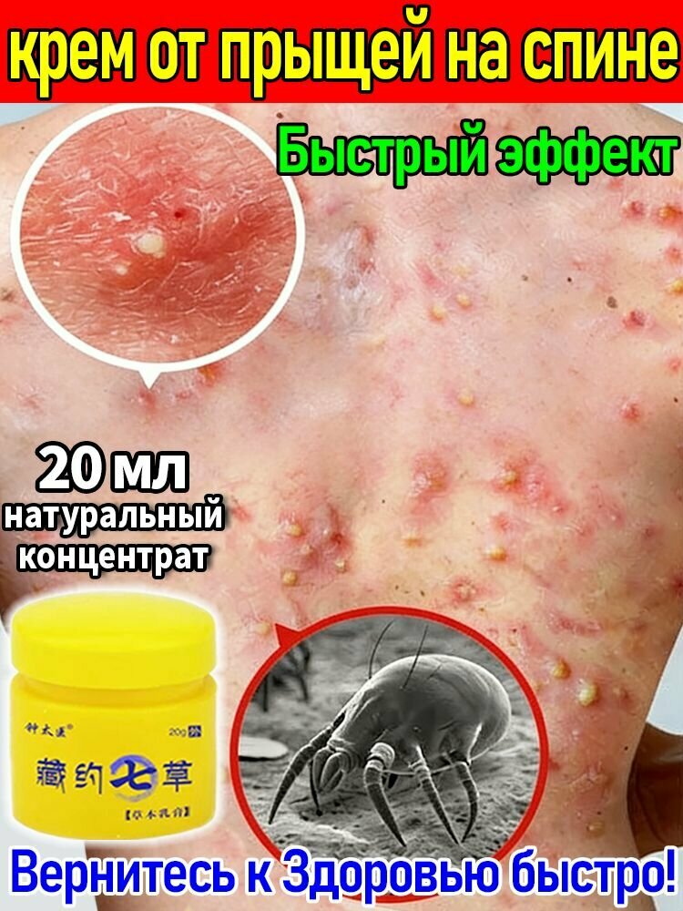 Мазь от чесотки и демодекоза для спины