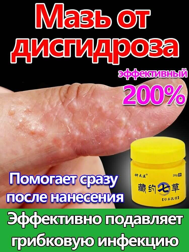 Мазь от зуда и пузырьков на коже, 20 г Успокаивает, снимает раздражение, антибактериальный эффект