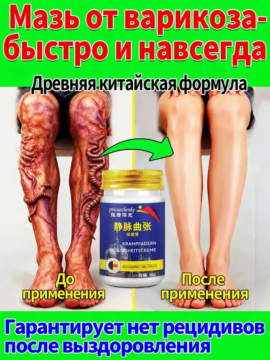 50 г Куперофаг мазь от варикоза，Мазь от варикоза вен на ногах китай