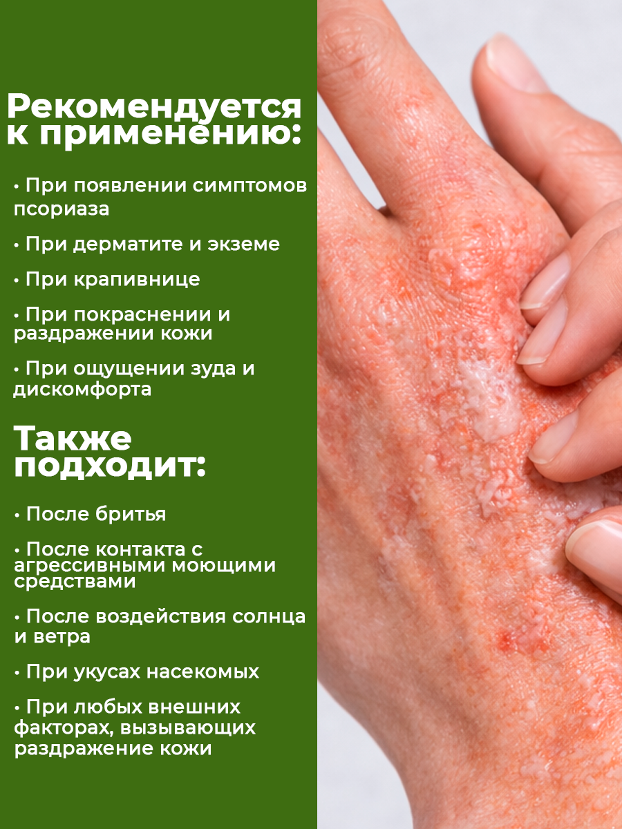 Крем от псориаза Псори-мазь, натуральный состав, туба, 50 мл