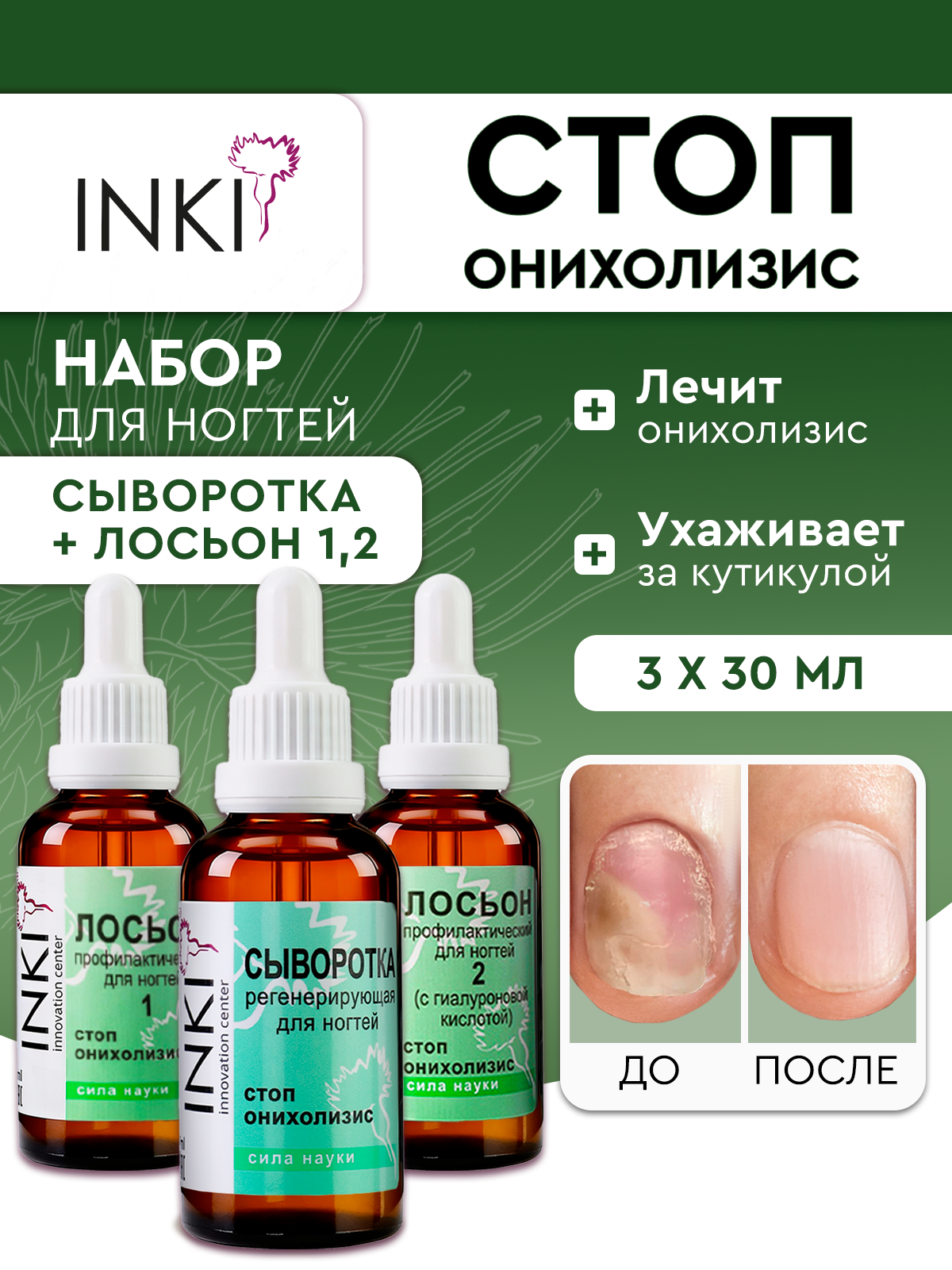 Набор от грибка ногтей "Стоп Онихолизис" сыворотка и лосьон 1и2