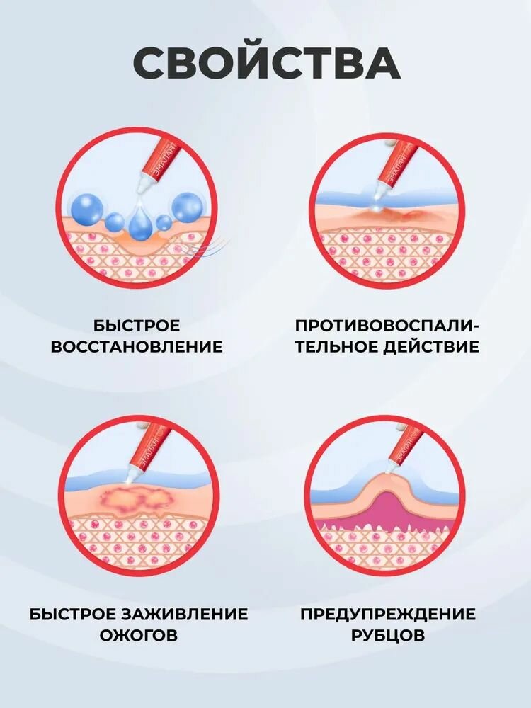 Средство от растяжек — фото 1
