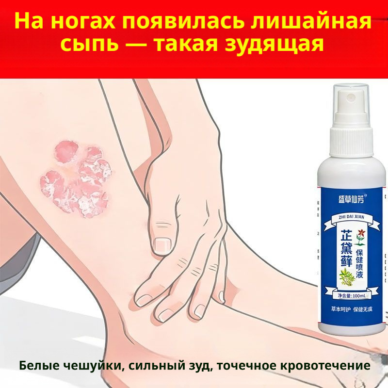 【Стойкий монетный лишай】 Специальный против зуда препарат для серьезных кожных лишаев, псориаза, красных пятен, чешуи, сухости и зуда, кожных лишаев и паховых лишаев