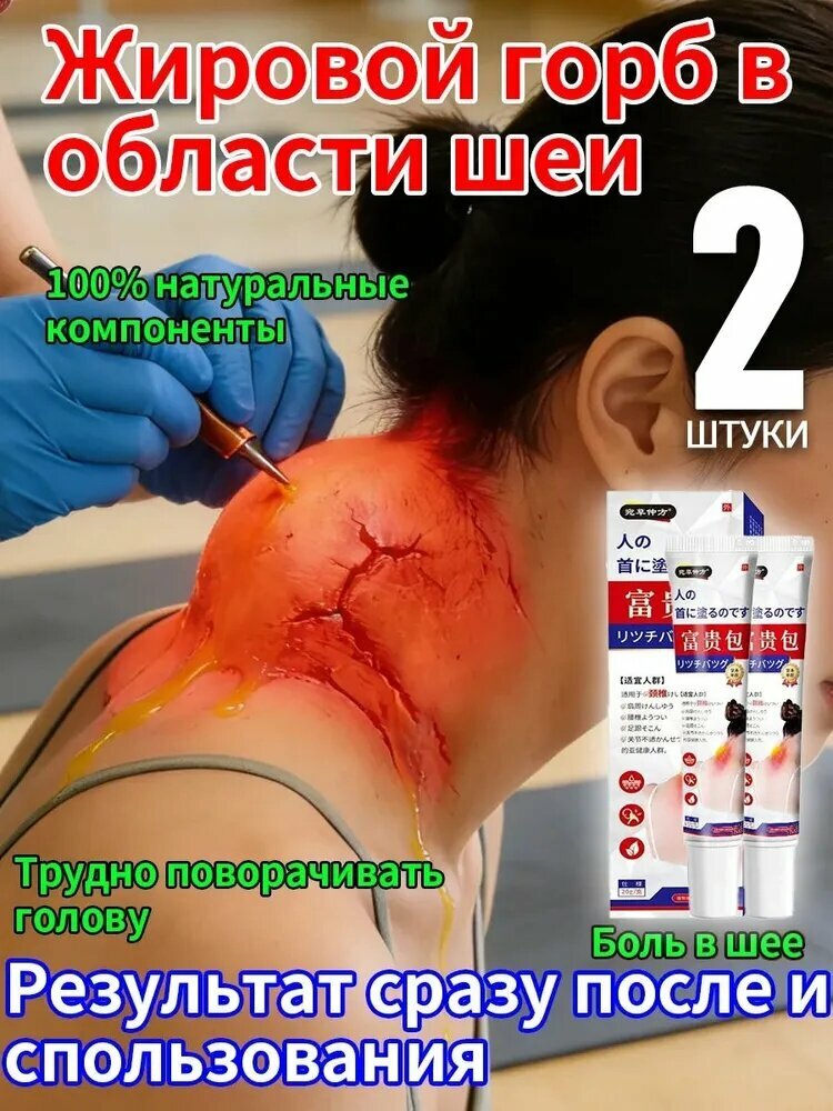 2 штуки, мазь для устранения жирового образования на организм