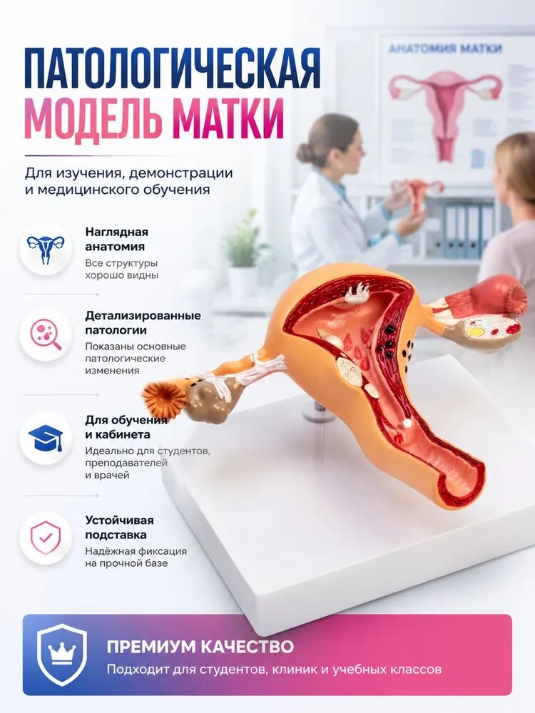 Макет Органы матки, патологии 24х12х20см / 9278899
