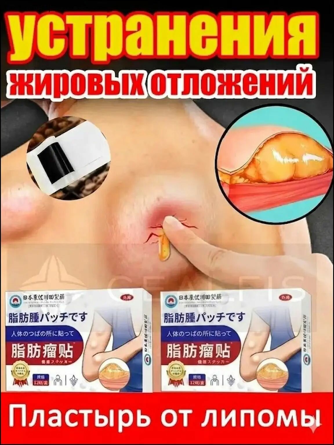 Качественный пластырь из Китая для рассасывания подкожных шишек, липом и жировиков, 24 штуки, используется для лимфоузлов.