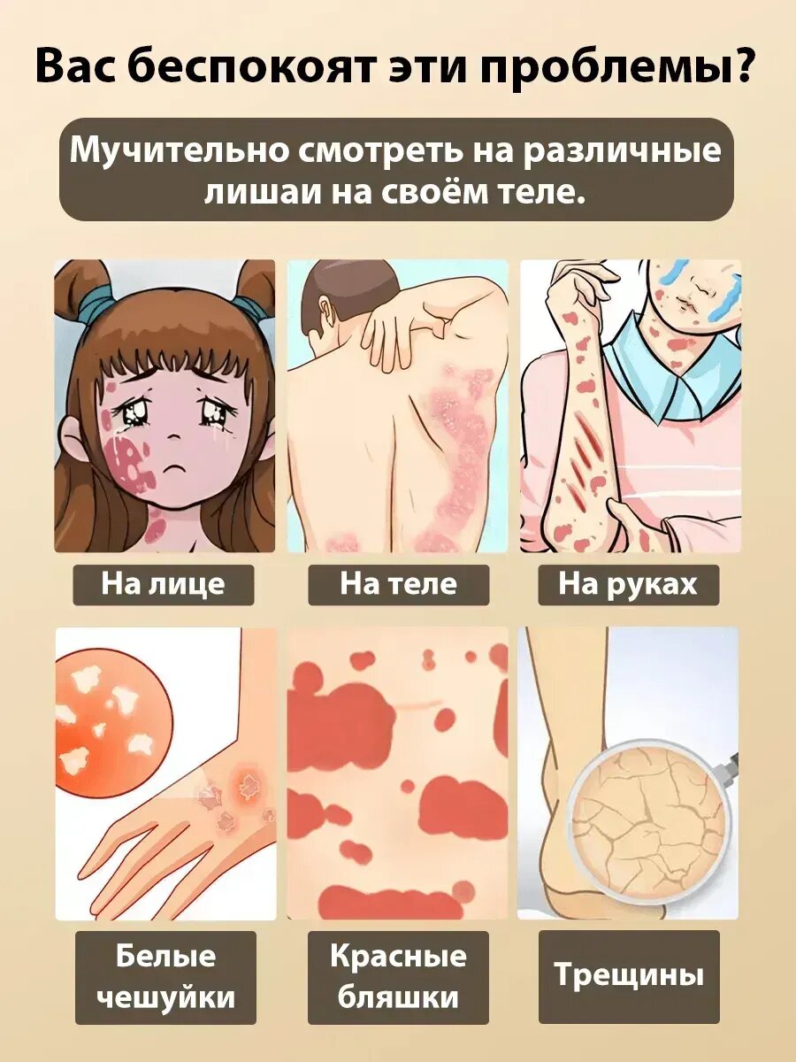Мазь от псориаза китайская эффективная