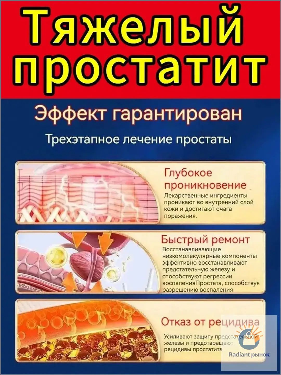 Пролонгатор, Стикер — фото 1