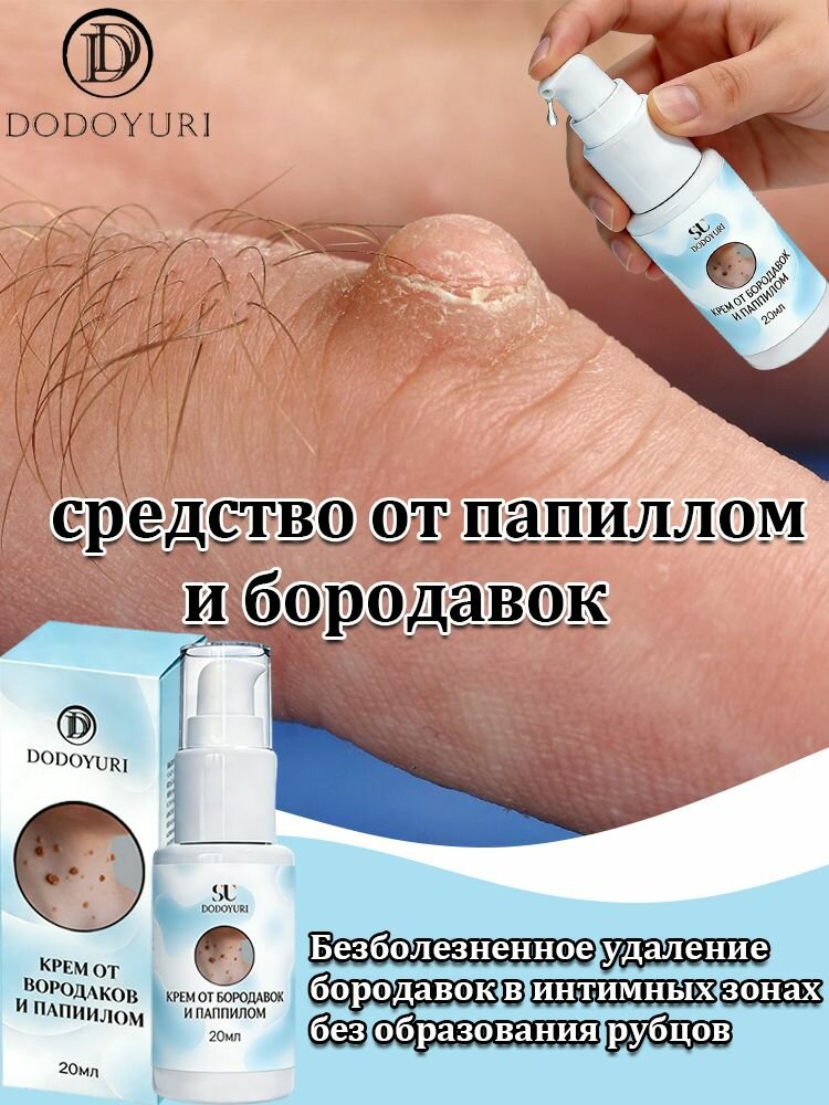 DODOYURI Крем от бородавок и папиллом, средство для удаления родинок и кожных наростов, безболезненное применение в домашних условиях, 20 г