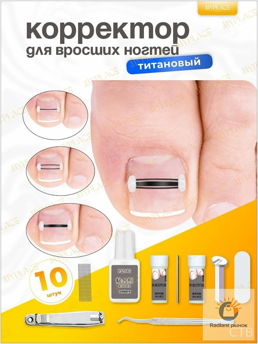 Набор инструментов , комплект корректоров для лечения вросших ногтей на ногах