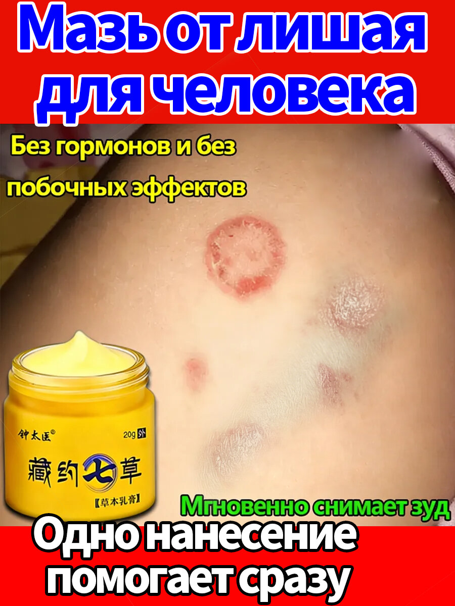 Мазь от псориаза и лишая для человека, негормональная, антибактериальная, заживляющая, 20г
