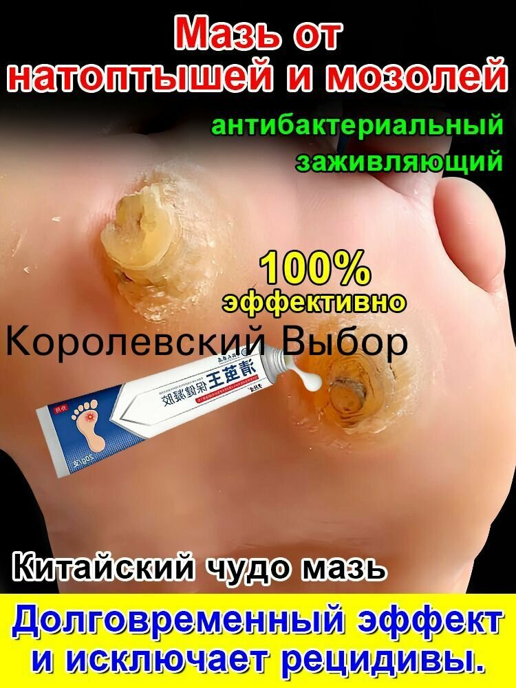 Mазь от мозолей стержневых и натоптышей , Крем от сухих мозолей, шипицы, бородавок, натоптышей,20 г.