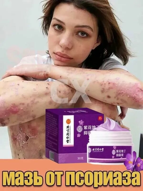 Мазь от псориаза Негормональная мазь от зуда для лечения псориаза, дерматита и экземы, порезов, облегчения зуда, 20 г.