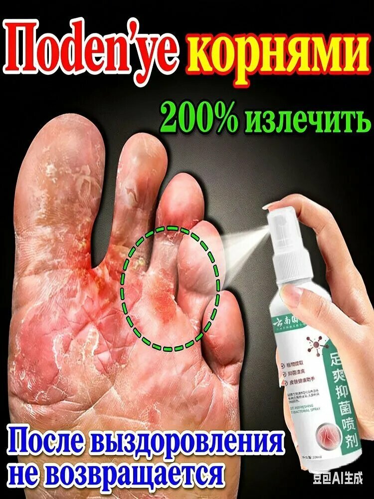 Противогрибковые спреи, мази от трещин на пятках и стопах, псориаза, зуда, микоза, лечение желтых, толстых, пустых и поврежденных ногтей на ногах и их стерилизация