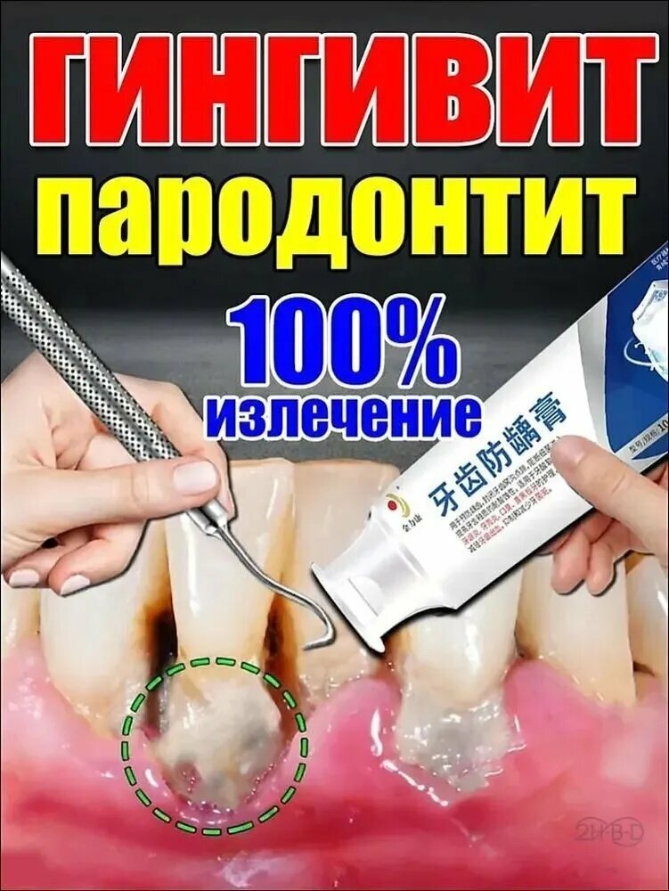Лечебная зубная паста от пародонтита и воспаления десен с натуральными травами 100 мл
