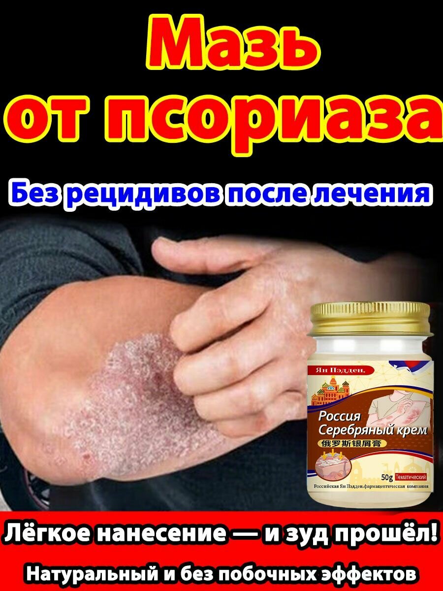 Мазь для лечения псориаза, экземы, дерматита, лишая, угревой сыпи, прыщей, способна быстро снять раздражение и покраснение кожи,50г